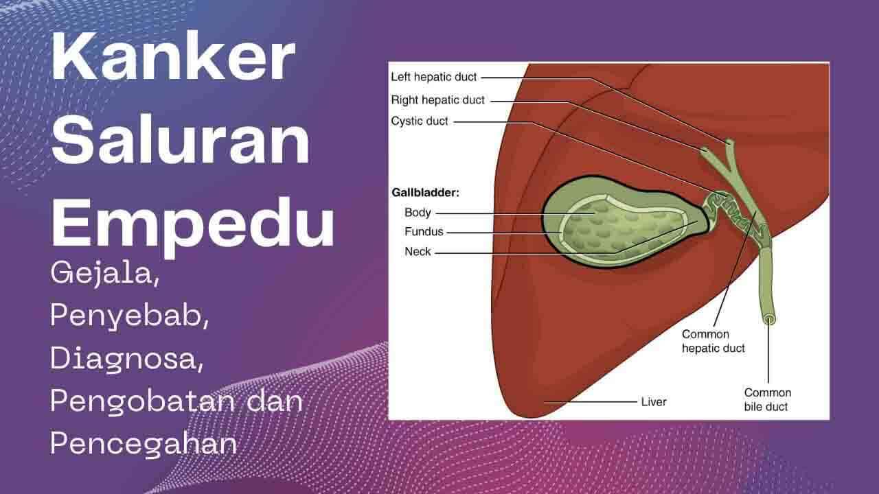 Kanker Saluran Empedu: Gejala, Penyebab, Diagnosa, Pengobatan Dan Cara ...