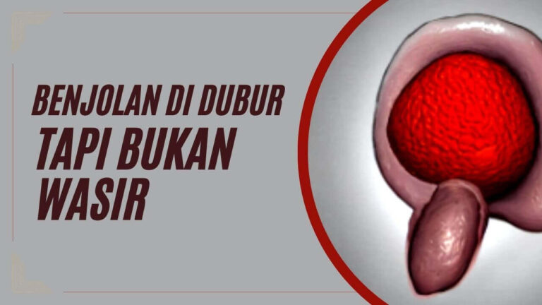 Leukosit Tinggi: Memahami Penyebab, Gejala, Dan Pengobatannya » 2026