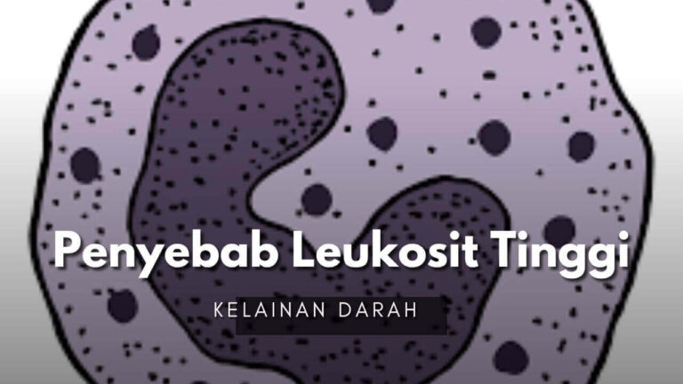 Leukosit Tinggi: Memahami Penyebab, Gejala, Dan Pengobatannya » 2025