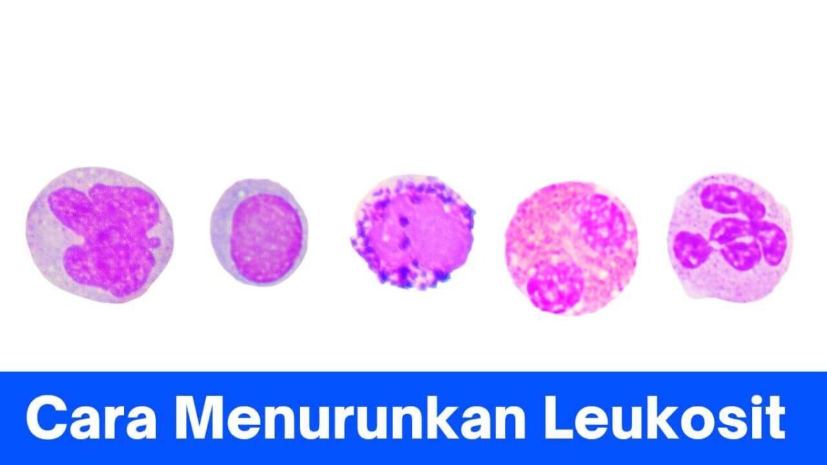 Leukosit Tinggi: Memahami Penyebab, Gejala, Dan Pengobatannya » 2025
